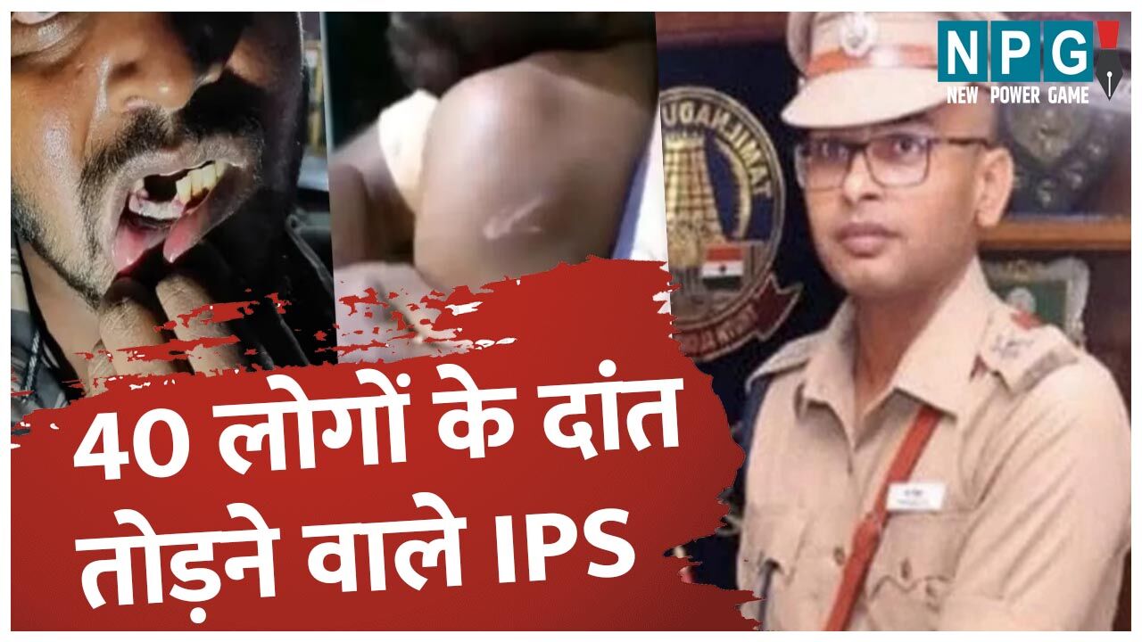CG IPS Suspended: दांत तोड़ने वाले आईपीएस हुए निलंबित, 40 लोगों के दांत उखाड़ने का आरोप ...